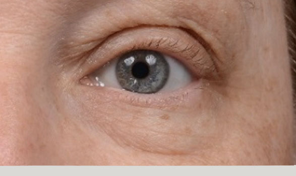 SkinMedica Instant Bright Eye Cream